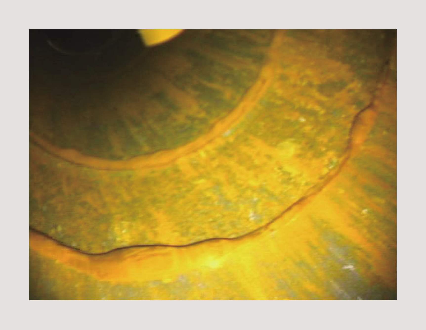 Ohmsha Online - 配管劣化診断の実施事例【設備の相談14】